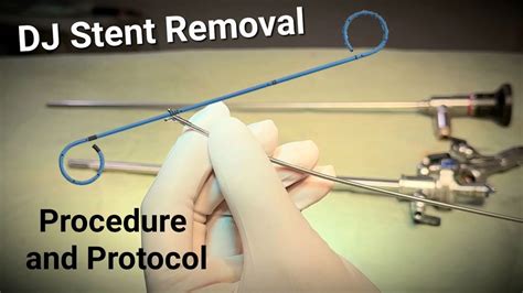 Cystoscopy And Dj Stent Removal Procedure And Protocol Dr Tayyab
