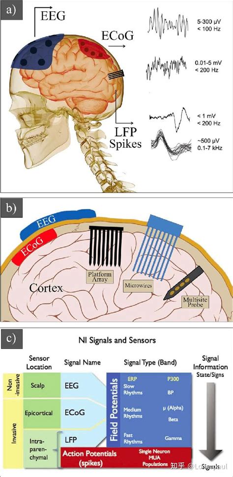 比头发丝儿还细的 线 如何获取大脑信号——解密马斯克neuralink电极工艺 知乎