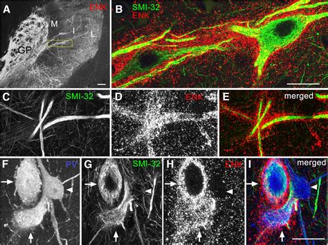 The Tail Of The Mouse Striatum Contains A Novel Large Type Of Gabaergic