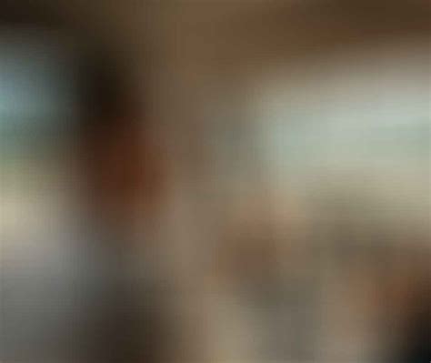 Hashimoto Thyroiditis And Eye Health Protect Your Vision Specialty