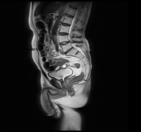 Mri Localizer Scout Or Survey Scan T1t2 And 3d Localizers
