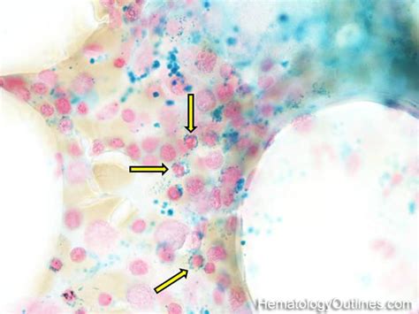 Hematologyoutlines Atlas