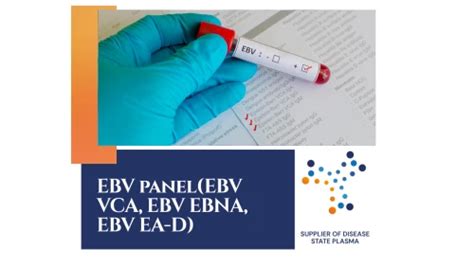 Ebv Panelebv Vca Ebv Ebna Ebv Ea D Abbaltis