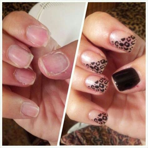 Shellac Before And After Shellac Nails Beauty