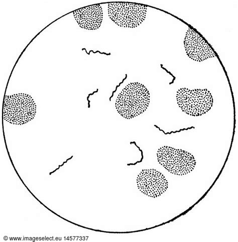 Medicine Medicine Sexually Transmitted Disease Syphilis Spirochaetes