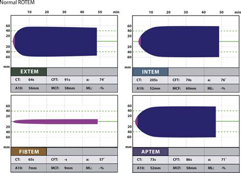 The Utility Of Viscoelastic Testing In Patients Undergoing Ir