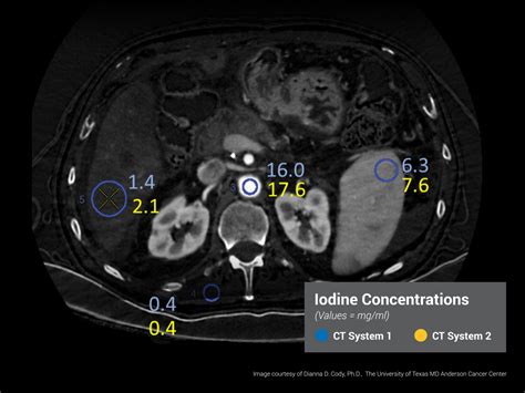 Multi Energy Ct Phantom Gammex™ Technology Sun Nuclear