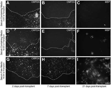 Increased Myelination Efficiency By Transplanted Opcs In Older Slices