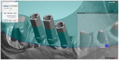 Three Dimensional Scanning Accuracy Of Intraoral Scanners For Dental