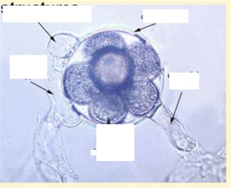D Oomycota Flashcards Quizlet