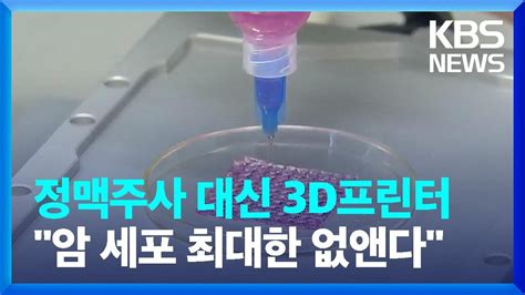 정맥주사 대신 3d프린터 암 세포 최대한 없앤다 Kbs 20230725 Youtube