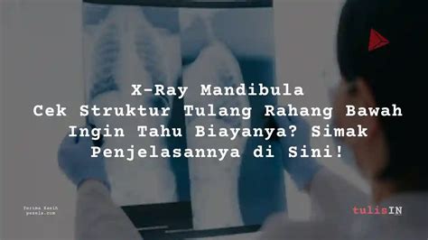 Berapa Harga Plain Foto Abdominal Bno Abdomen Ap Rontgen Perut Kekitaan