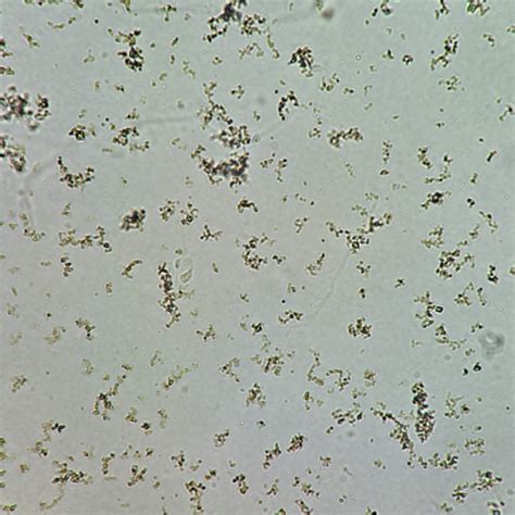 Amorphous Urates Identification And Clinical Significance