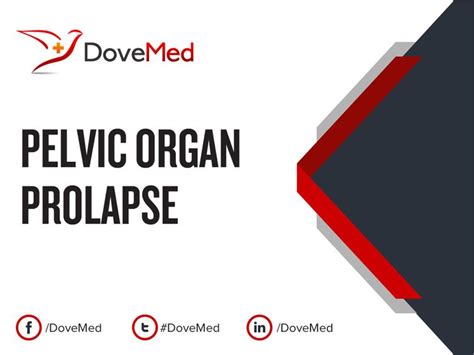 Pelvic Organ Prolapse Pop