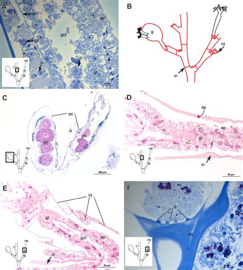 Coenosarc And Exoskeletal Structure Of Halecium Bermudense Congdon