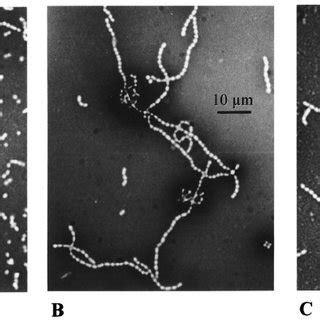 Arrangement Of The Gal Gene Cluster Of Lactococcus Lactis Mg1363