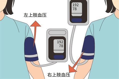 量血压图片 百度健康·医学科普