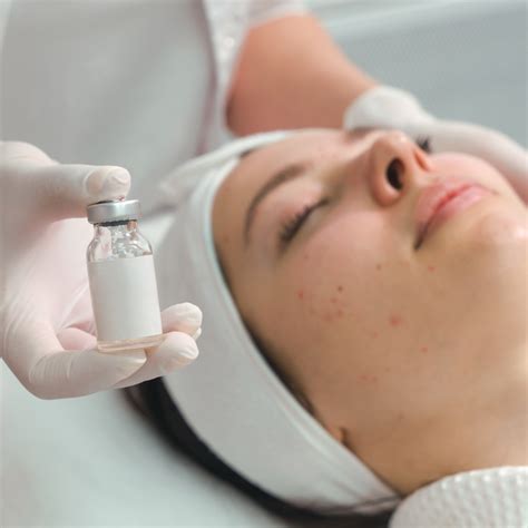 Acne Injections Nature Derma™