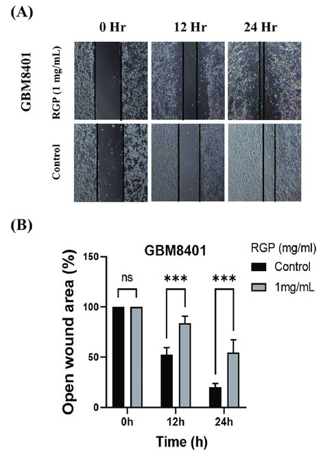 Rgp Inhibits The Migration Ability Of Gbm Cell Line A Gbm Cell Lines
