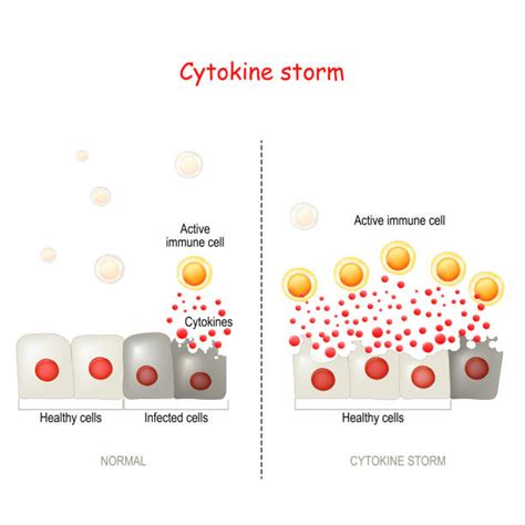 20 Cytokine Release Syndrome Stock Illustrations Royalty Free Vector