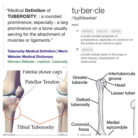 Tubercle