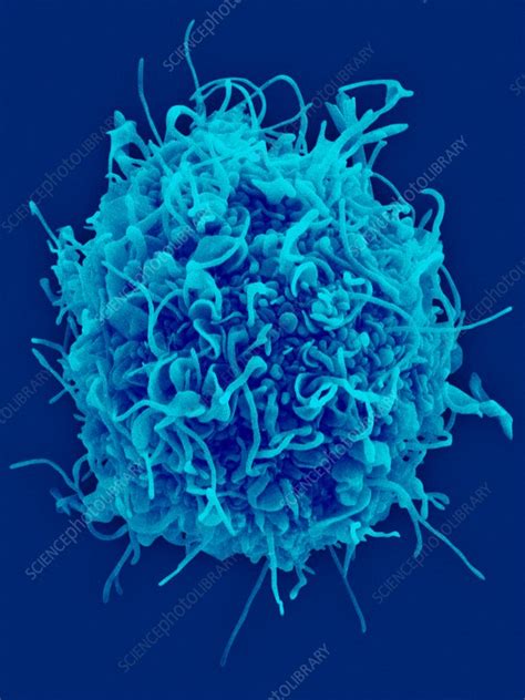 Human Dendritic Cells Sem Stock Image C0333561 Science Photo