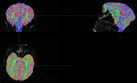 Preprocessing Steps For Sigle Shell Macaque Dwi Data Preprocessing