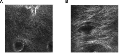 Topical Effects Of Sca® Cryptomphalus Aspersa Secretion Associat Ccid