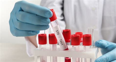 How Much Does An Std Test Cost In Dubai Servicemarket Blog