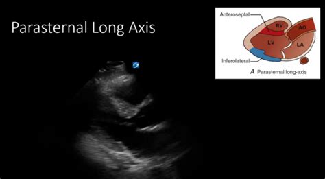 Ive Embedded Some Of The Slides Below However You Should Watch The Entire Video The Wall