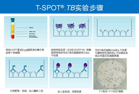 T Spottb 医学检验技术 爱比西广州医学技术有限公司