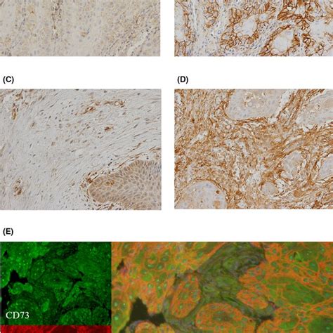 Expression Patterns And Localization Of Extracellular Matrix