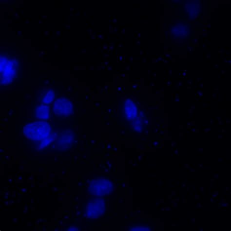Do I Have Mycoplasma Contamination Dapi Staining