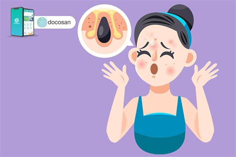 Mụn đầu đen Nguyên Nhân Dấu Hiệu Cách điều Trị Doctor Có Sẵn