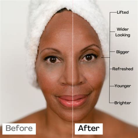 Eyelid Lifting Strips L 60 Pcs King Soopers