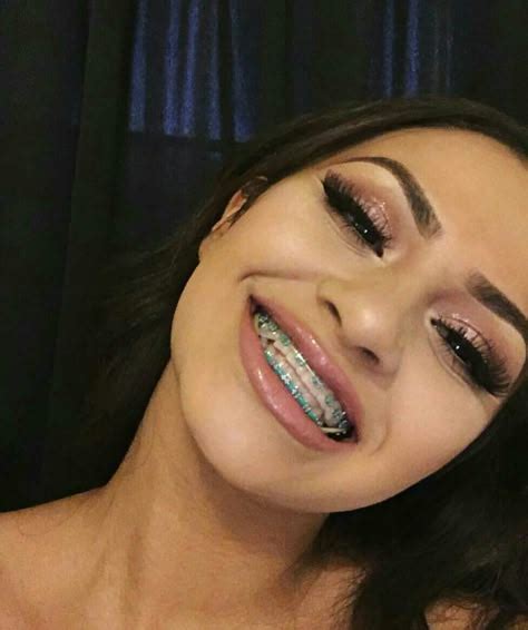 ғᴏʟʟᴏᴡ ʀᴇᴇᴄᴇᴍᴇᴏᴡ ғᴏʀ ᴍᴏʀᴇ ツ ♡ Brace Face Cute Braces Hair Color