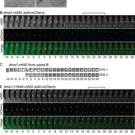 Dynamics Of Dma1 Localization Through The Cell Cycle A And D Live Download Scientific