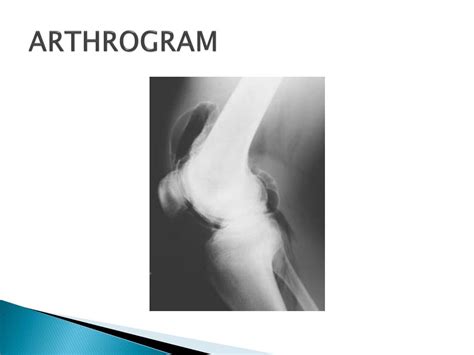 Ppt Contrast Studies Powerpoint Presentation Free Download Id1414794