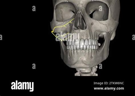 The Zygomatic Nerve Is A Branch Of The Maxillary Nerve It Arises In The