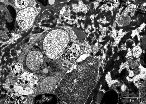 Microscopy Innovations Biological Tissue Fixation Embedding And