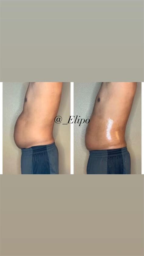 Eboni Clayton Mitchell Opens E Lipo A Body Sculping And Natural Body Contouring Spa Inside Salon