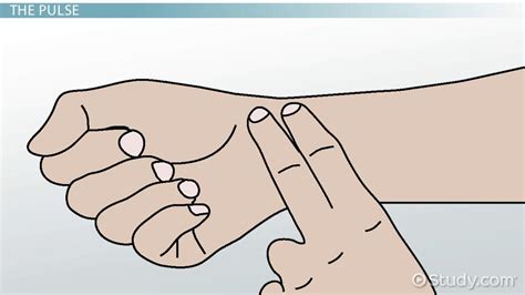 Pulse Deficit Definition Calculation And Causes Video