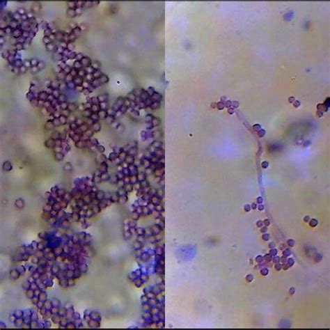 Microscopic Image Of Staphylococcus Aureus Download Scientific Diagram