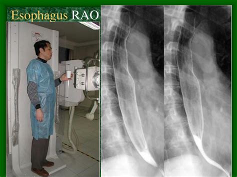 Ppt Radiology Powerpoint Presentation Free Download Id 1041654