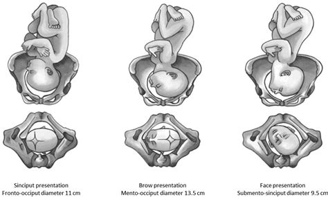 Sonographic Evaluation Of The Fetal Head Position And Attitude During