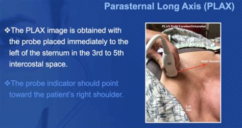 Tte Flashcards Quizlet