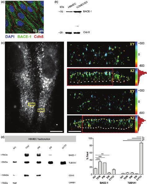 Subcellular Localization Of Bace 1 In Human Brain Endothelial Cells A