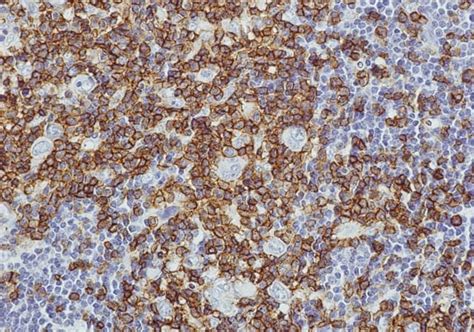 Cd45ro Cd45ro Antibody Ihc Sakura Finetek Usa
