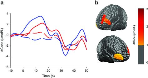 Fnirs Results At 6 Years Old During The Verbal Fluency Task Expressive Download Scientific
