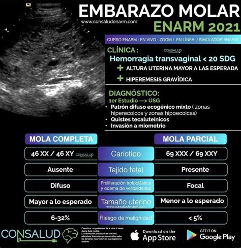 Embarazo Molar Ecografia Embarazo 1 Mes Ecografia Embarazo 2 Meses